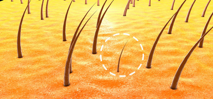 ¿Pelo miniaturizado? Así puedes recuperar grosor en el cabello